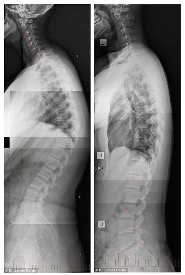 3 Proven Ways Smartphones and Screen Time are Harming Children’s Health